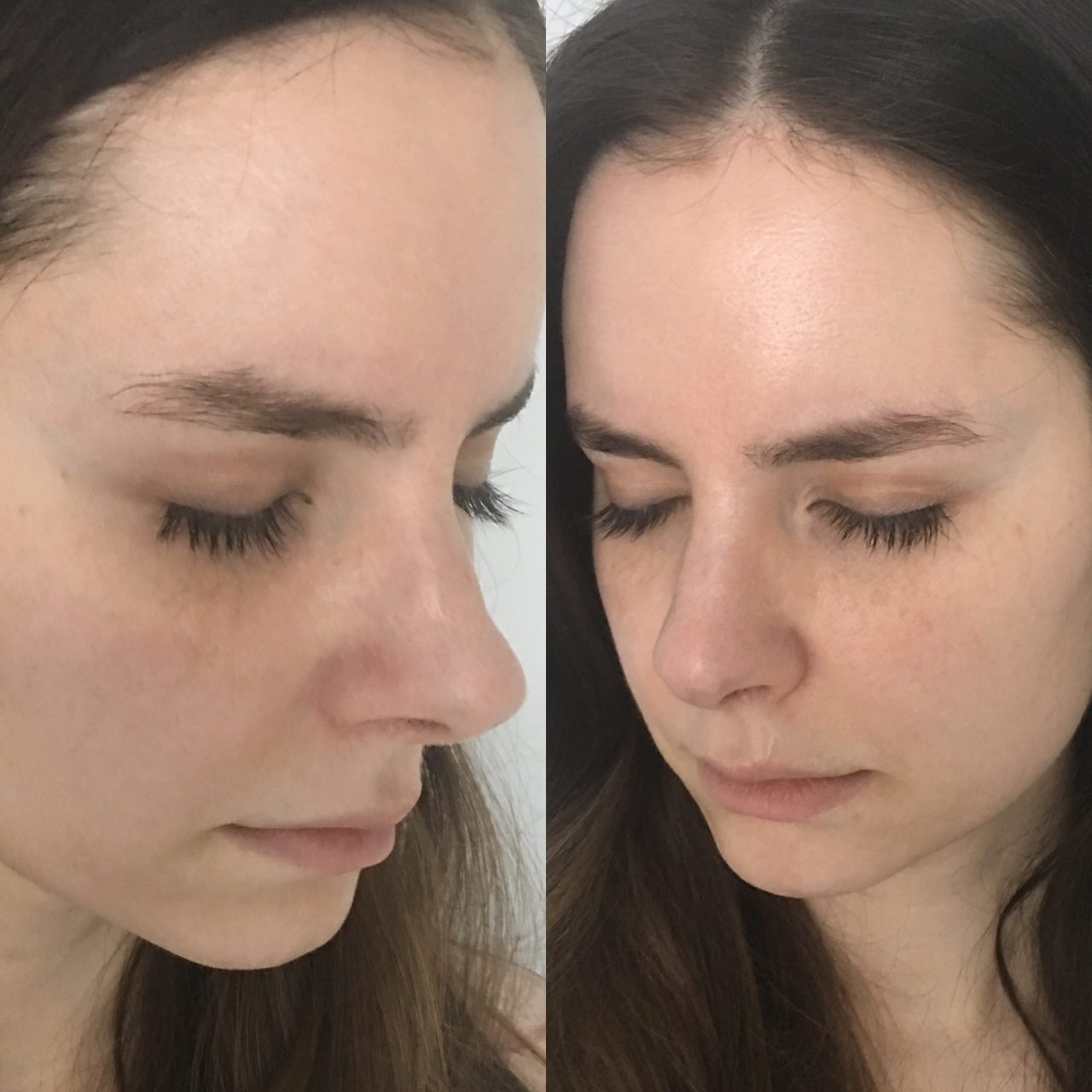 The Truth About Rodan + Fields: Do the Products Work? - Veronika's Blushing